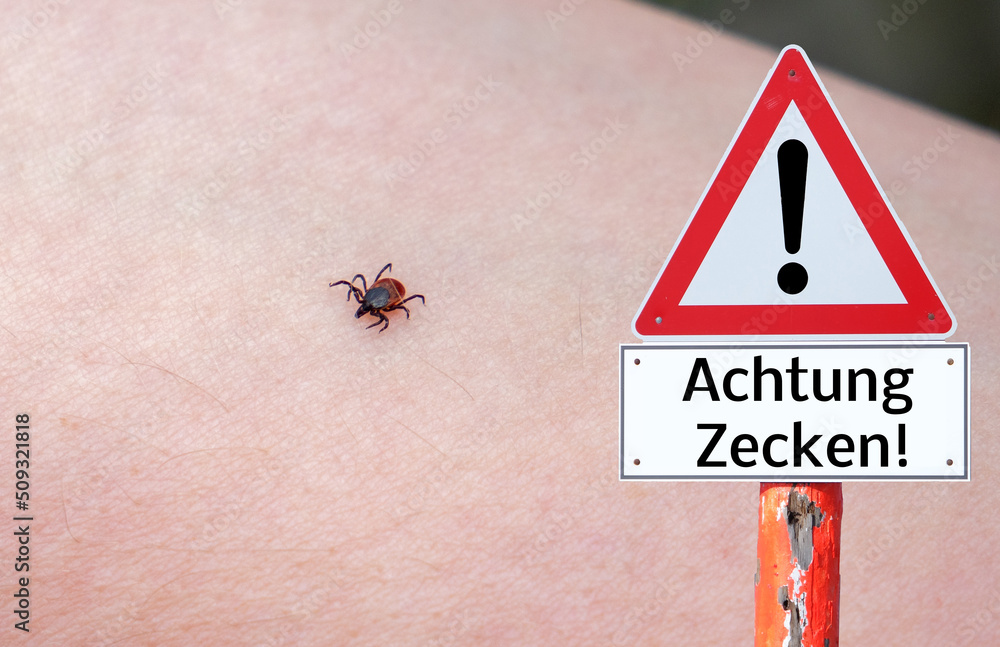Attention ticks Warning sign with a tick on the arm in german Stock ...