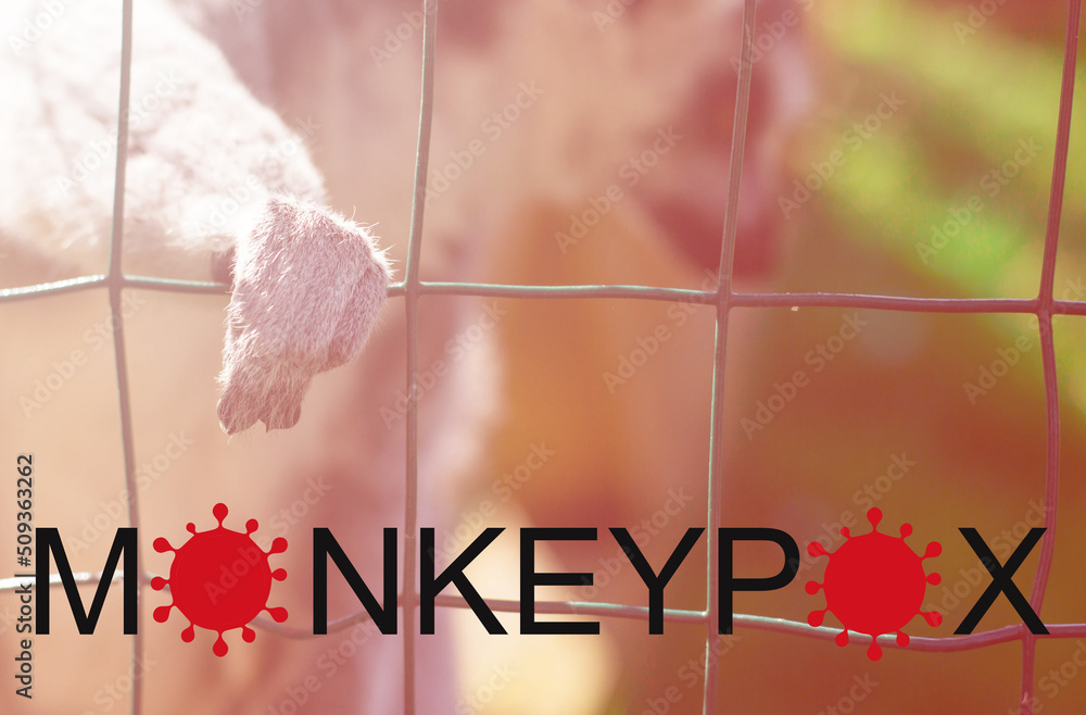 Monkeypox outbreak concept. Monkeypox is caused by monkeypox virus ...