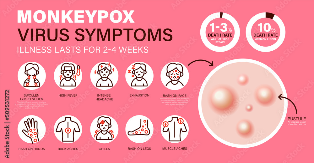 Monkeypox virus Symptoms. New cases of Monkeypox virus are reported in ...