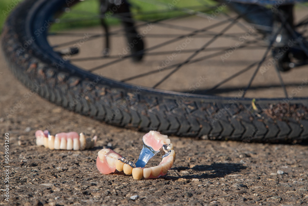 Denture and a fallen bike on the street. A fall from a bicycle often ...