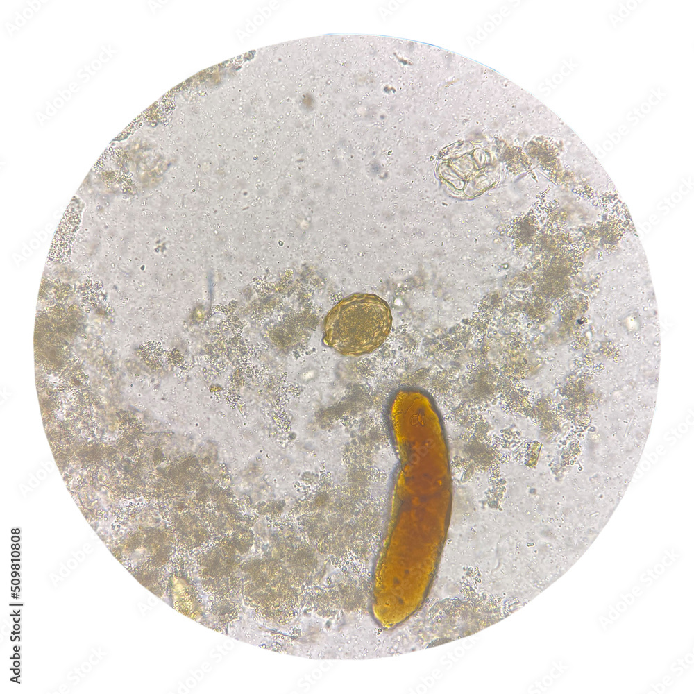 Egg of parasite in stool exam. Stock Photo | Adobe Stock