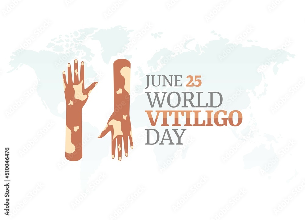 vector graphic of world vitiligo day good for world vitiligo day ...