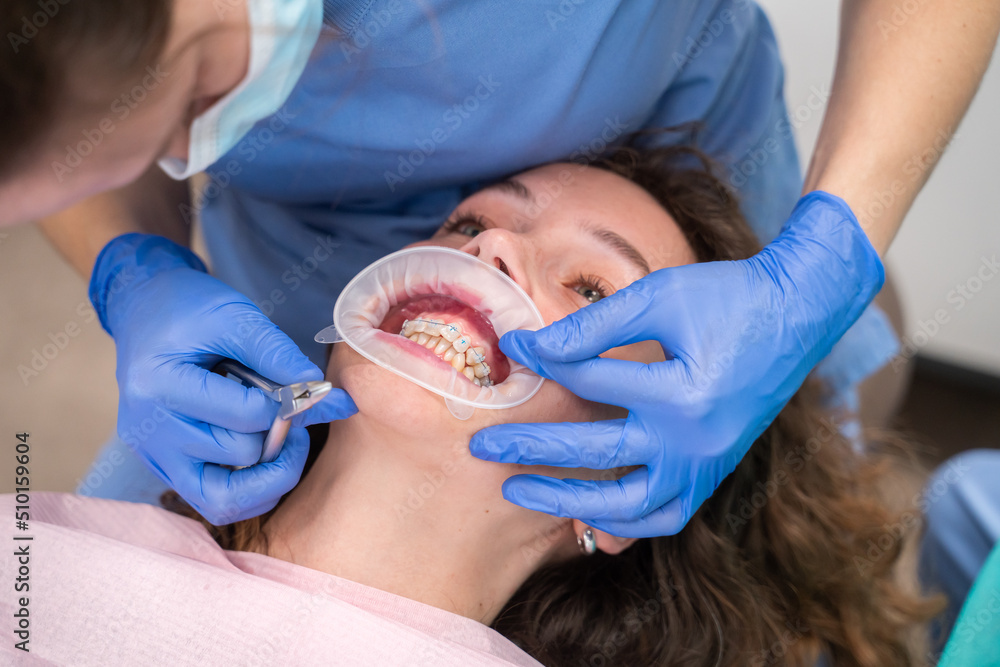 Orthodontic treatment. Adjusting Brackets. Stock Photo | Adobe Stock