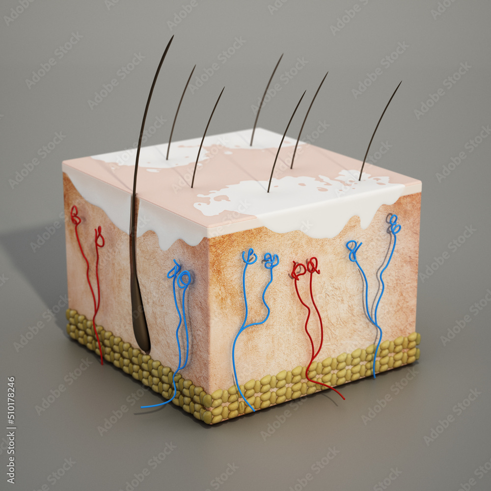 3D structure of a human skin section with vitiligo disease. 3D ...