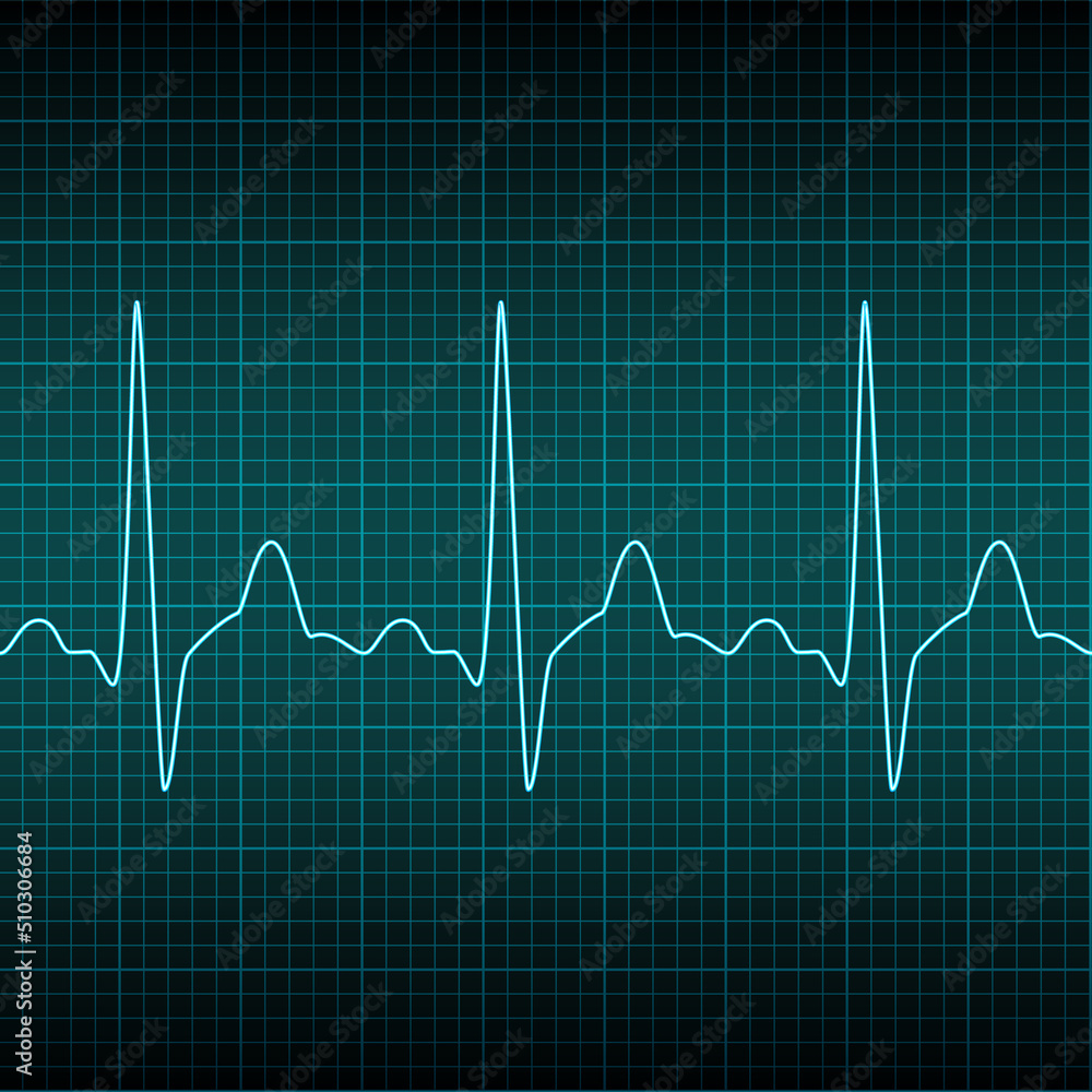 Electrocardiogram seamless background. Heart beat rate ekg recording ...
