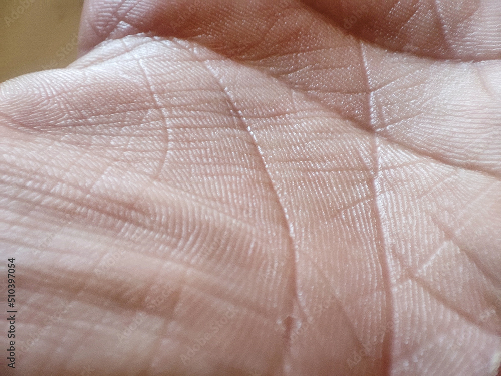 Macro human skin texture. Caucasian healthy skin. Dermatitis concept ...