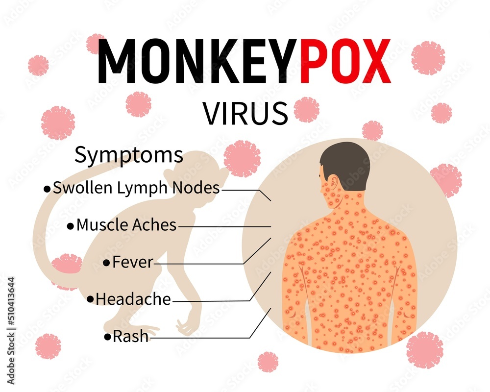 Monkeypox symptoms infographic. Banner with text, a silhouette of a ...
