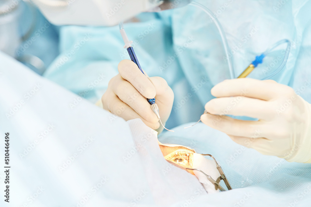 Ophthalmology laser microscope operation. Doctor surgery in clinic ...