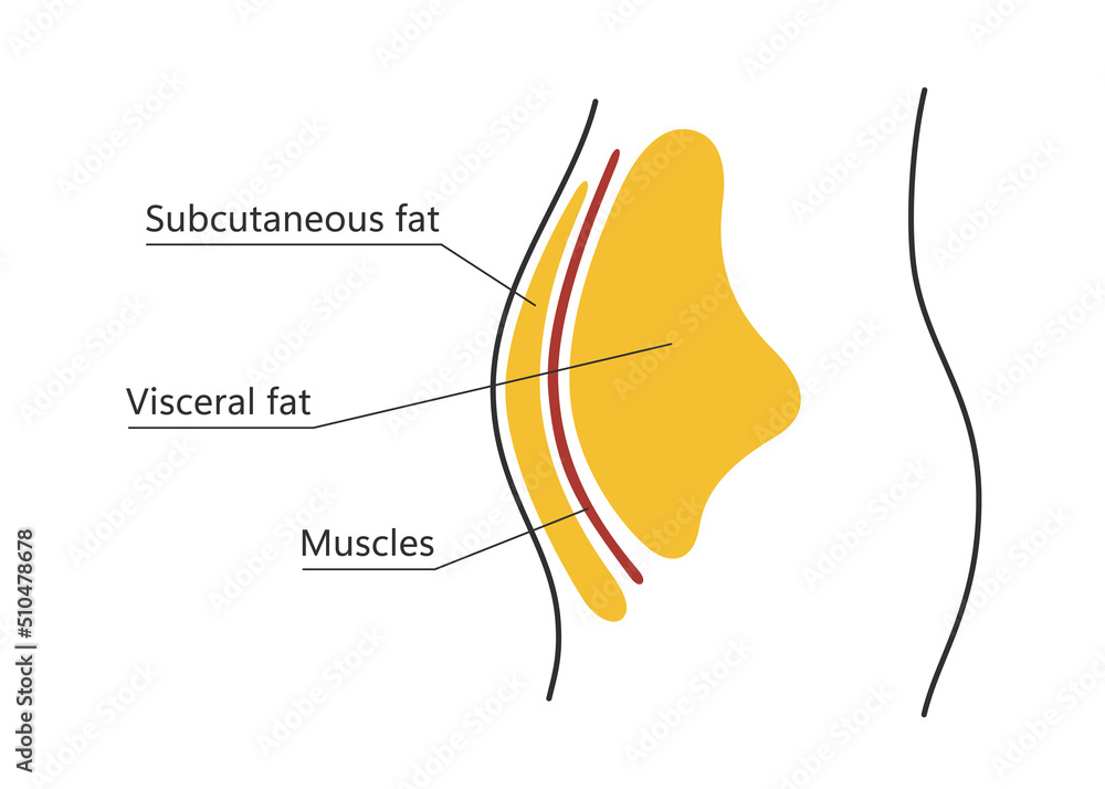 Visceral and subcutaneous fat around waistline. Location of visceral ...