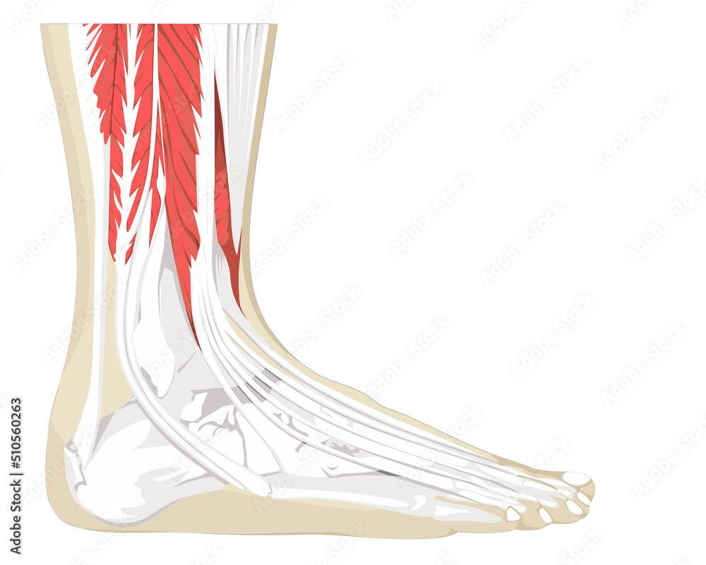 High Ankle Sprain Diagram Stock Illustration | Adobe Stock