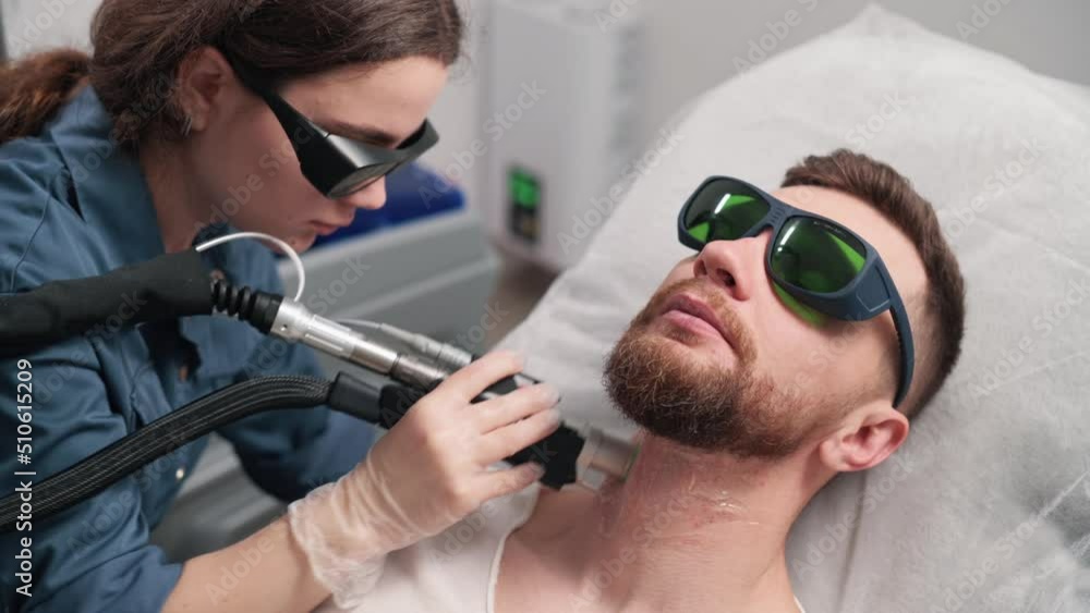 Laser depilation of beard contour. Man getting permanent laser face ...