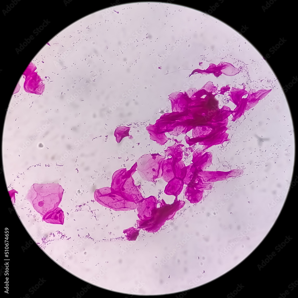 bacteria Gram staining under microscope Stock Photo | Adobe Stock