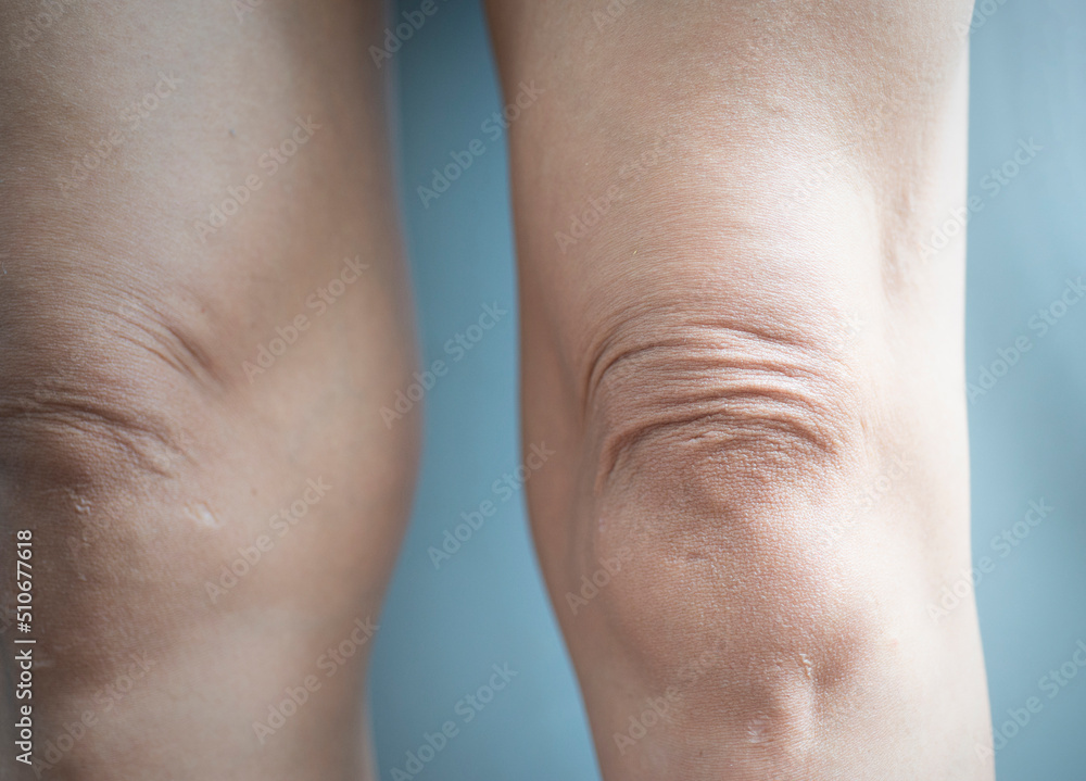 Picture of wrinkles on the skin of different parts of the human body ...