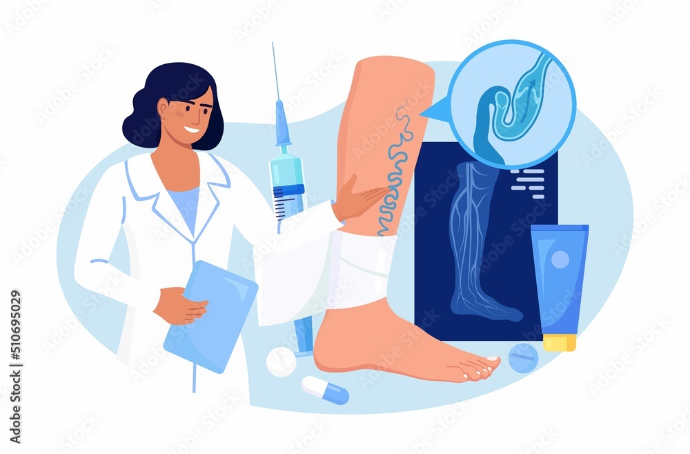 Vein Thrombosis and Varicose Treatment. Surgeon treat vascular diseases ...