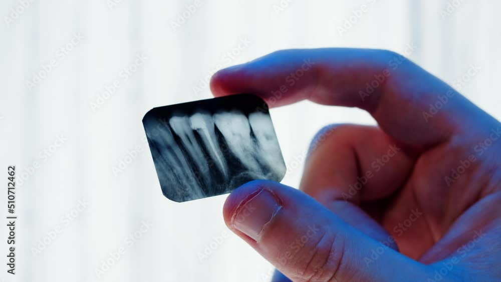 Teeth x-ray close-up. Doctor examining xray of tooth, Magnetic ...