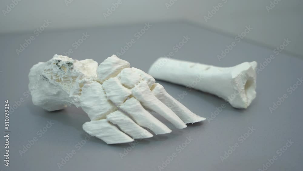 Orthopedic Implants. 3D print for medical implants. Prototype of human ...