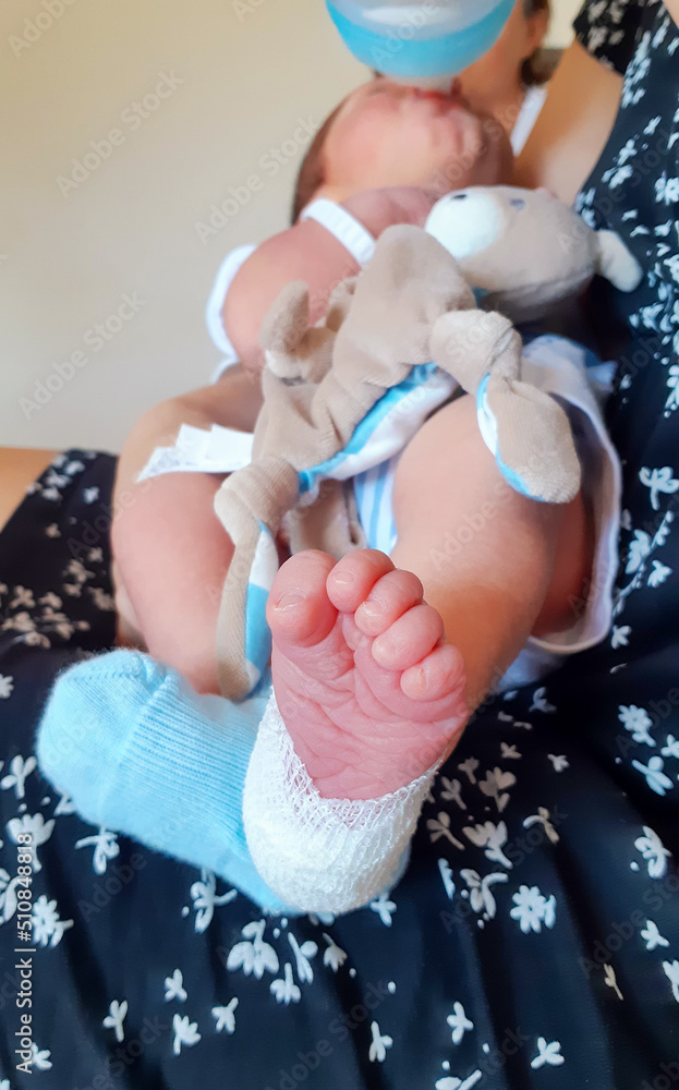 Detail of the foot of a medicated newborn after a blood draw from the ...