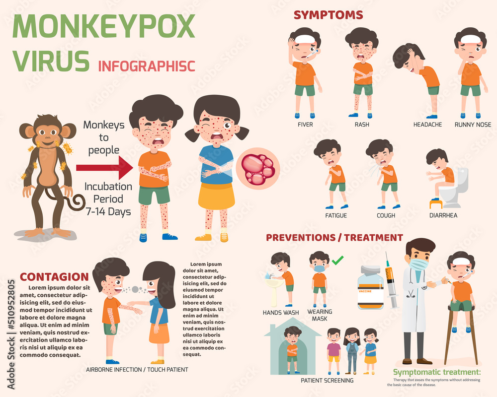 Monkeypox virus infographics elements, Human body with rash. Symptoms ...