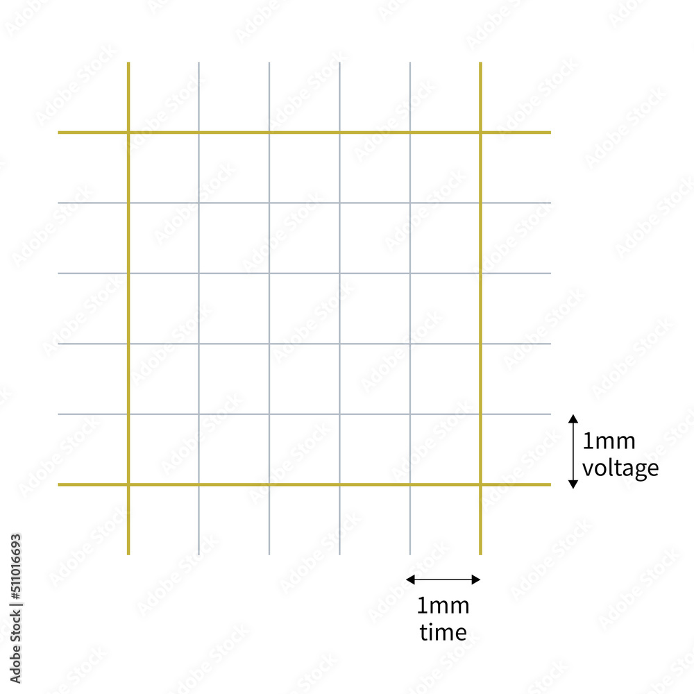 Fototapeta The ECG paper is composed of a small square with a side ...