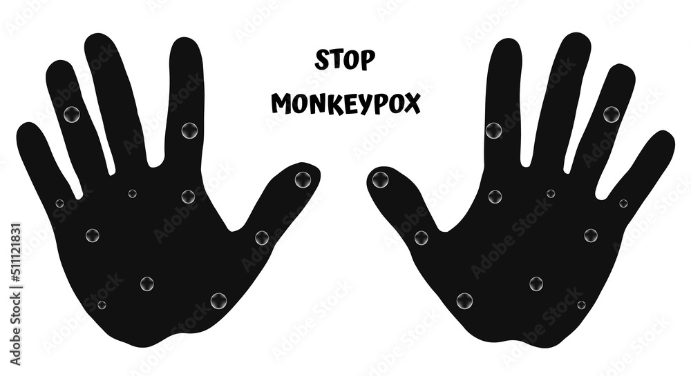 Stop Monkeypox black and white vector illustration, human hands with ...