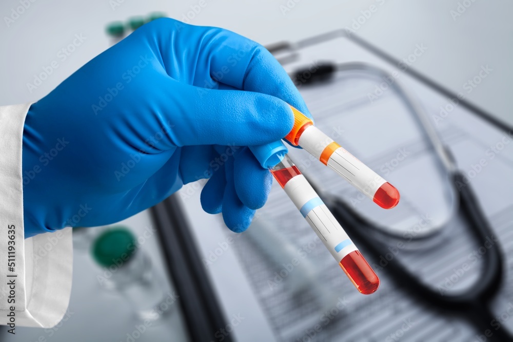 Blood Sample Tube For Analysis Of Test In The Laboratory Doctor blood-sample-tube-for-analysis-of-test-in-the-laboratory-doctor