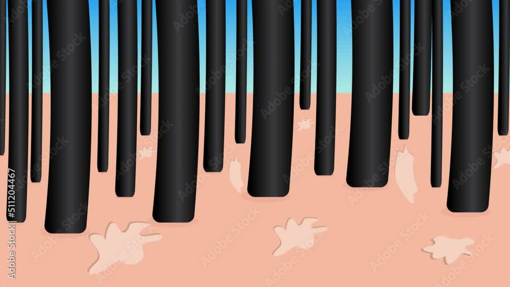 Dandruff growing on head skin with long hair 4K animation. Hair scalp ...