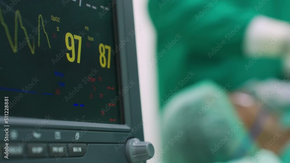 Close-up view of the screen of patient monitor displays vital signs ECG ...
