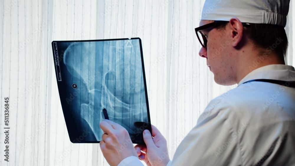 Doctor examining pelvis hip x-ray close-up. Magnetic Resonance Image of ...