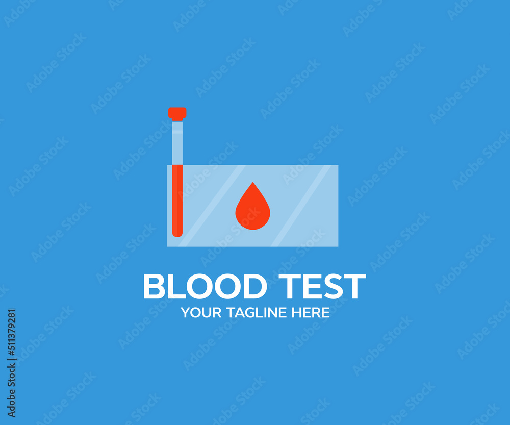 Blood test tubes, examining blood test tubes at her laboratory dna ...