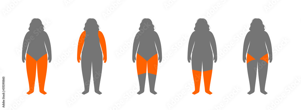 Overweight problem concept Stock Vector | Adobe Stock