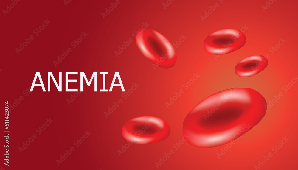 Anemia realistic vector, Red blood cells 3d mock up design. with text ...