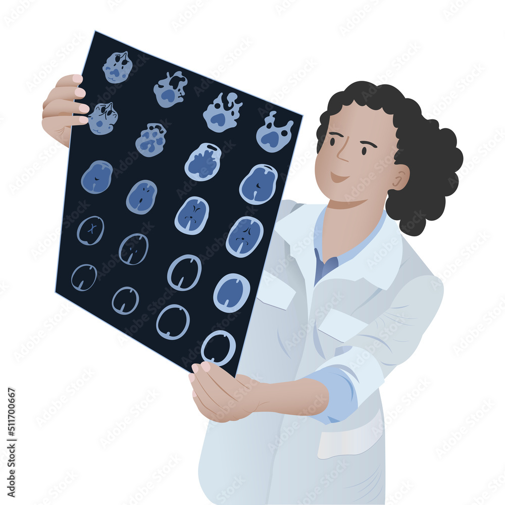 Diagnosis of diseases of the brain in a doctor looking at magnetic resonance imaging (MRI ...