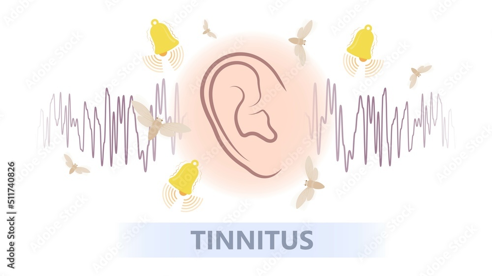 Tinnitus disorder a ringing sound in the ear hearing loss wave level ...