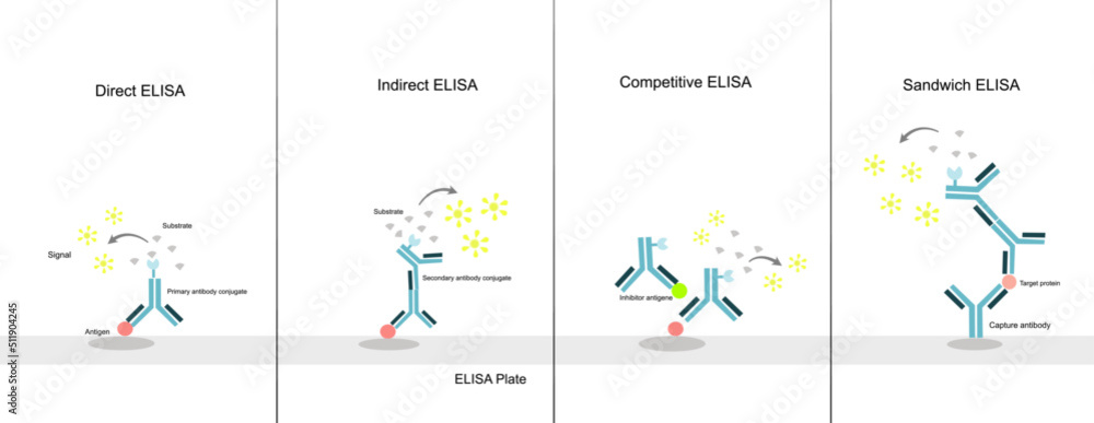 The principle of Enzyme-Linked Immunosorbent (ELISA) Assay: Direct ...