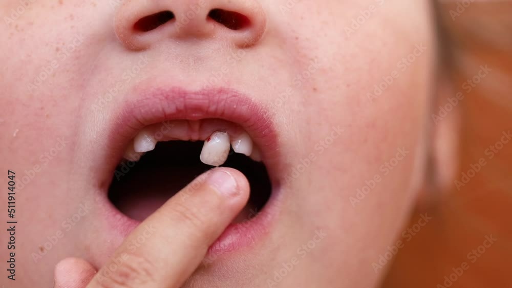 Vidéo Stock Unrecognizable close up kid mouth, baby teeth problem ...