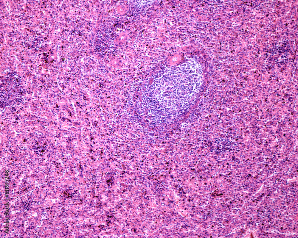 Human spleen. White and red pulp. Lymphoid follicle Stock Photo | Adobe ...