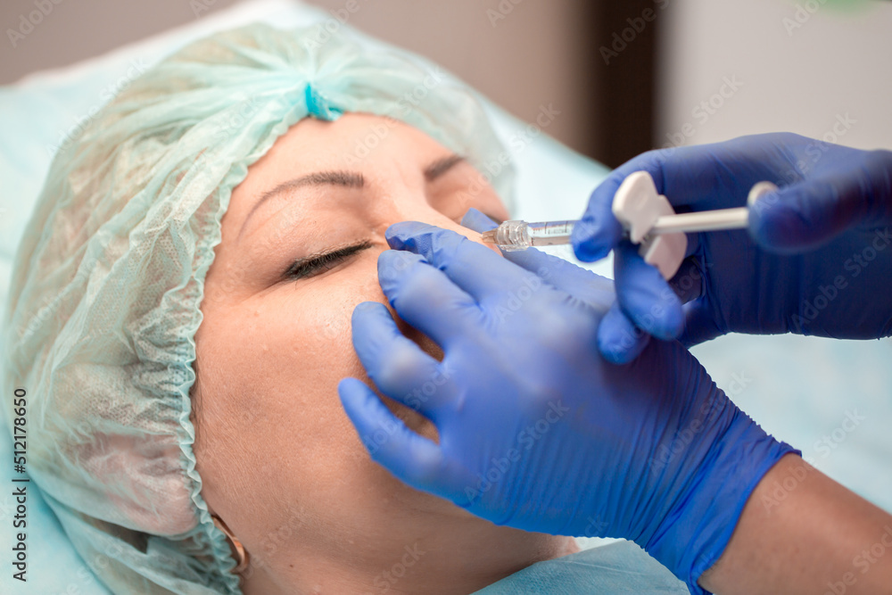 Cosmetic procedure for non-surgical rhinoplasty. Beautician injects ...