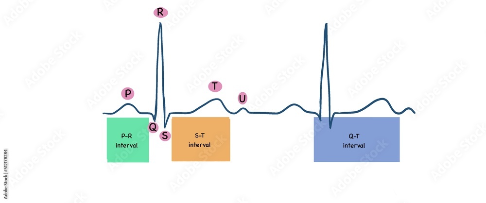 ECG image show normal ECG with waves and intervals Stock Illustration ...