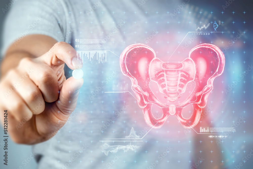 X-ray of a patient's pelvis, hip joint skeleton, medical concept ...