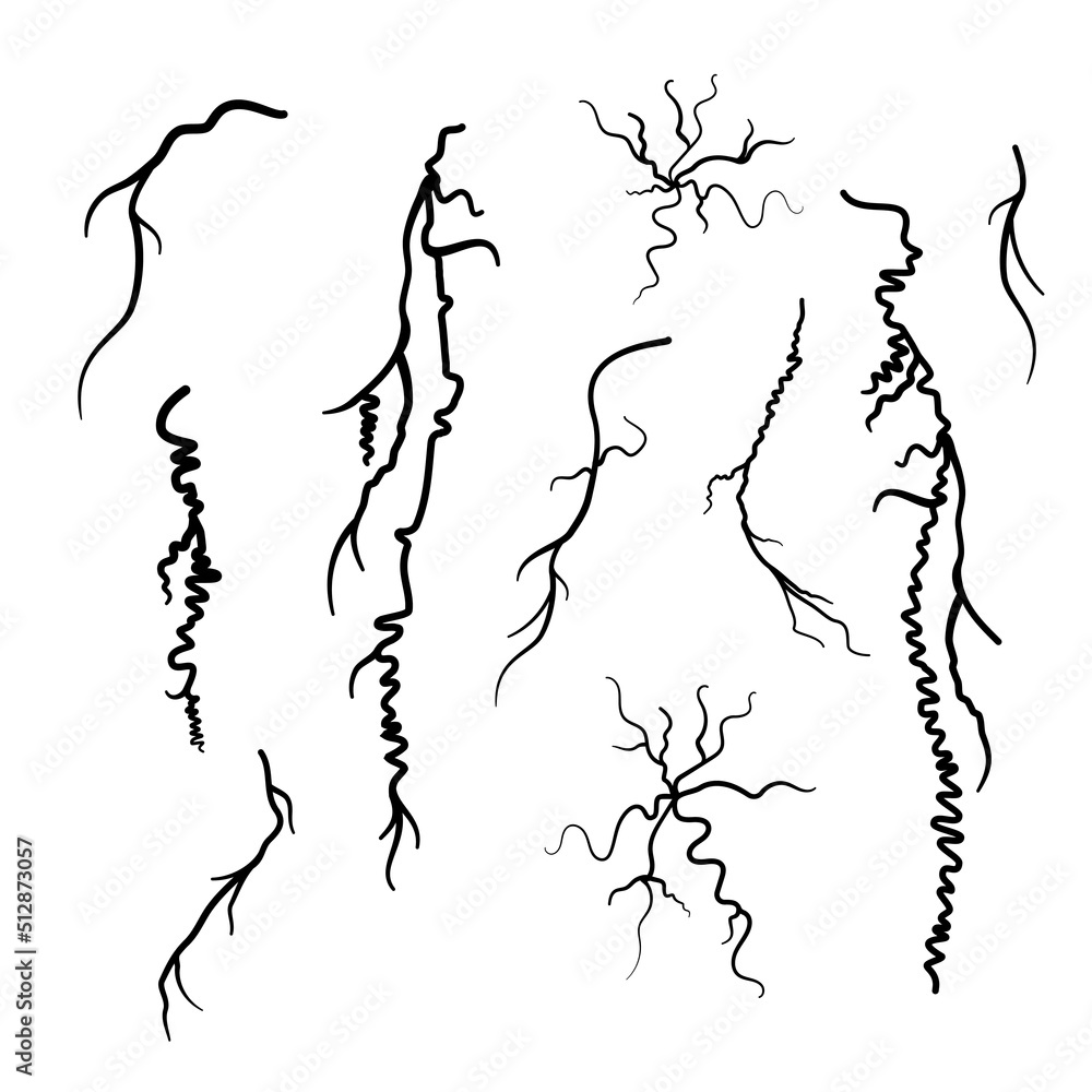 Varicose veins anatomy Stock Vector | Adobe Stock