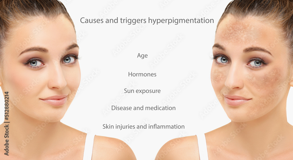 Ageing skin ,internal and external causes of skin aging, signs of skin ...