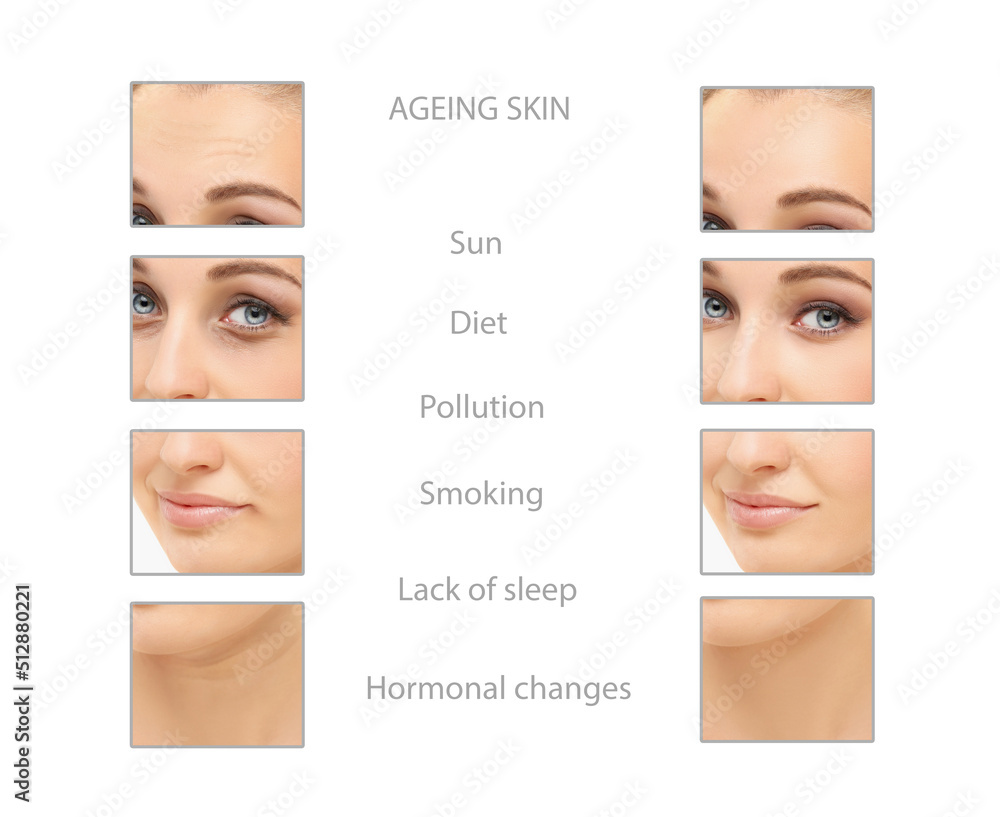 Ageing skin ,internal and external causes of skin aging, signs of skin ...