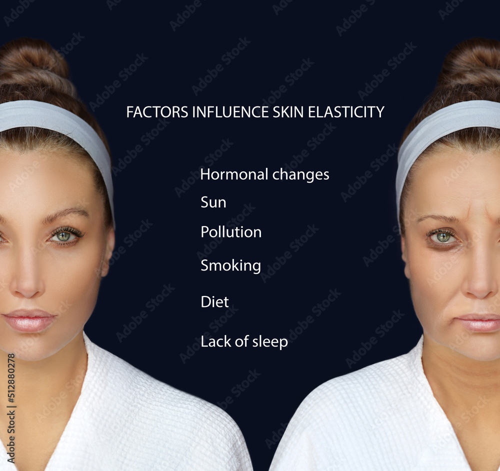 Ageing skin ,internal and external causes of skin aging, signs of skin ...