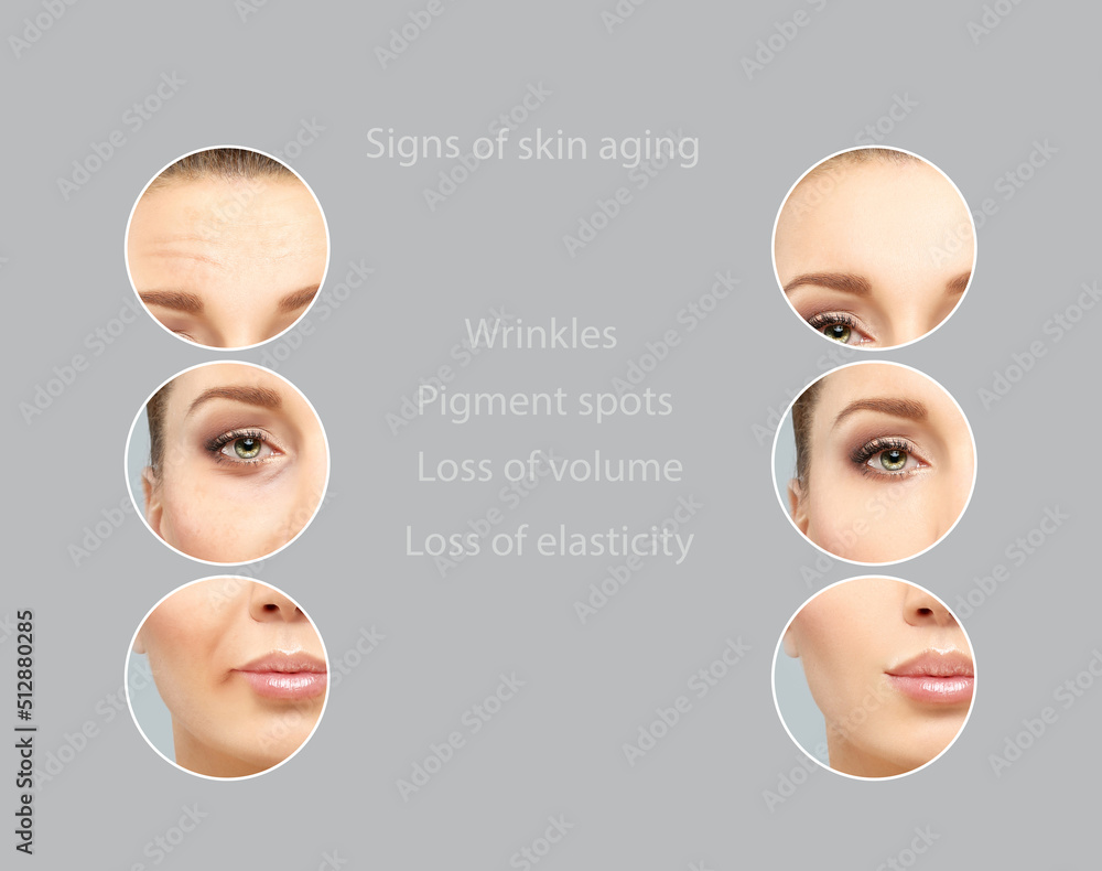 Ageing skin ,internal and external causes of skin aging, signs of skin ... Ageing skin ,internal and external causes of skin aging, signs of skin ...