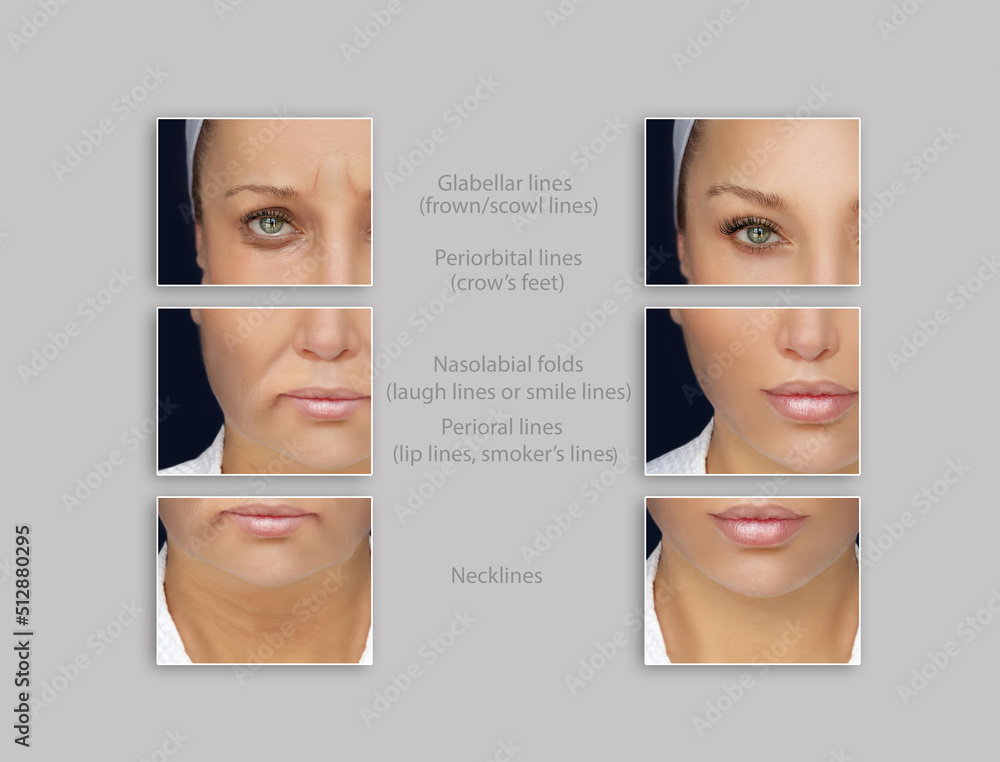 Ageing skin ,internal and external causes of skin aging, signs of skin ...