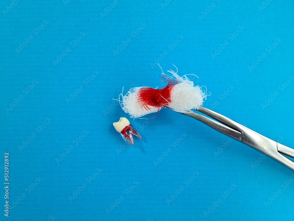Dental tools for tooth extraction on table Stock Photo | Adobe Stock