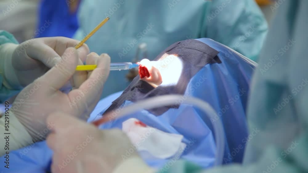 Functional rhinosurgery for the restoration of nasal breathing ...