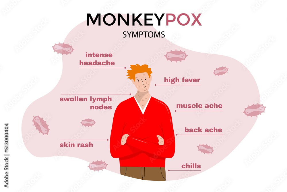 monkeypox symptoms. MPS virus infographic, list of symptoms. human and ...