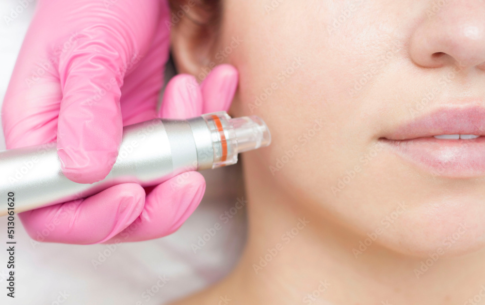 Needle mesotherapy. Cosmetologist performs needle mesotherapy on a ...