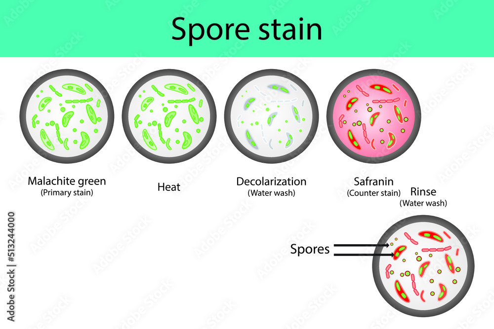 Spore staining microbiology lab technique steps diagram, using Malachite green and safranin ...